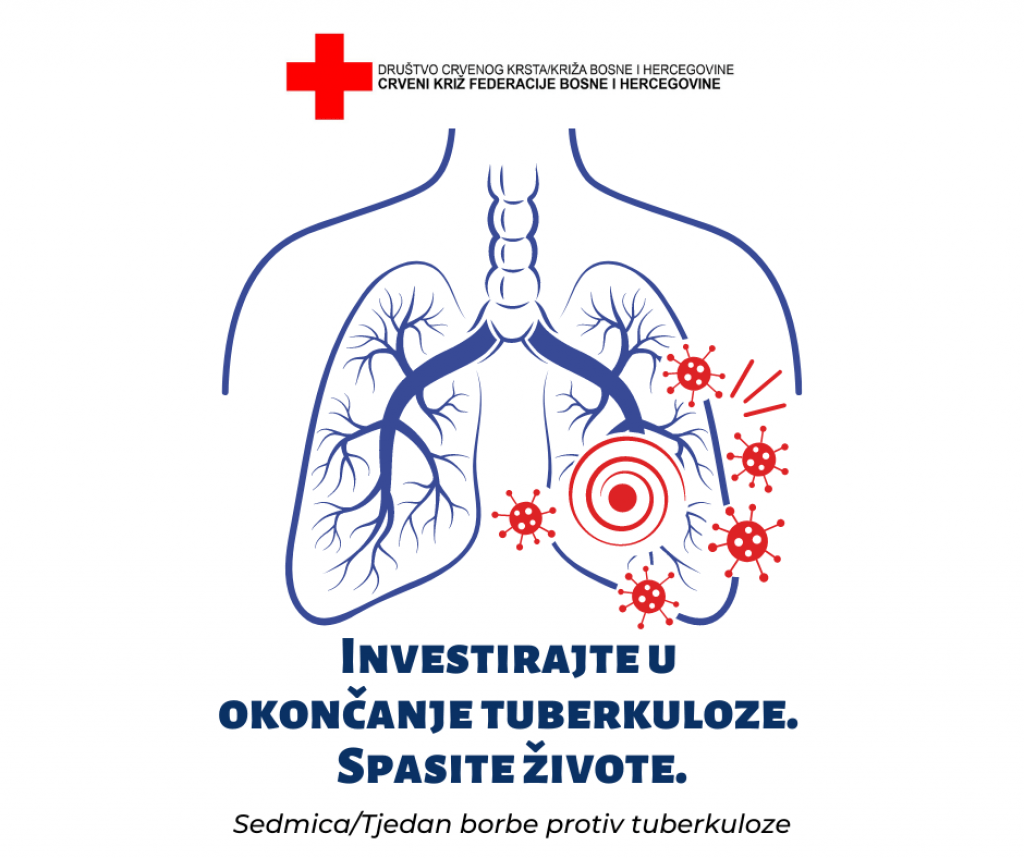 U Federaciji BiH u 2021. godini od tuberkuloze oboljele 293 osobe ...